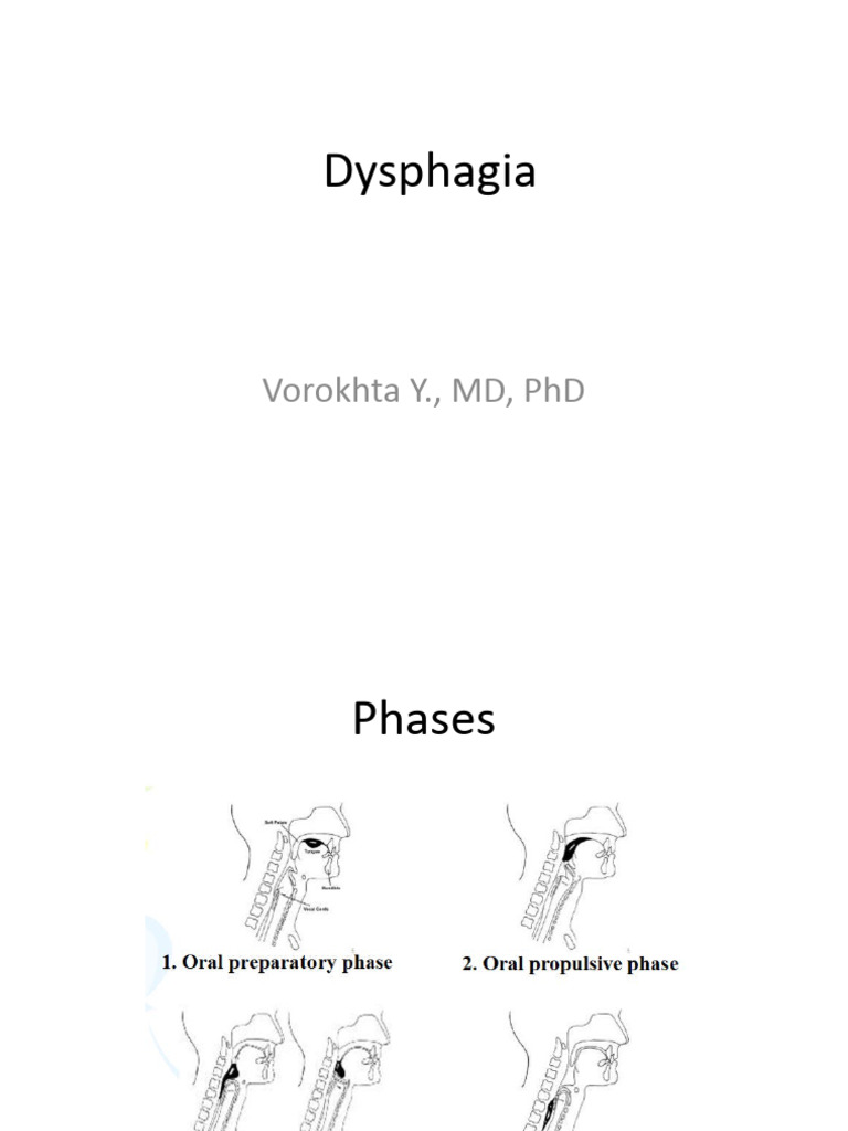 Dysphagia | PDF | Cerebellum | Tongue