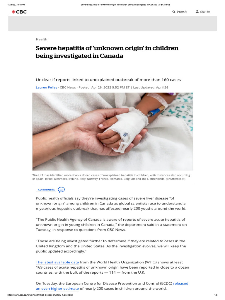 Severe Hepatitis of 'Unknown Origin' in Children Being Investigated in ...