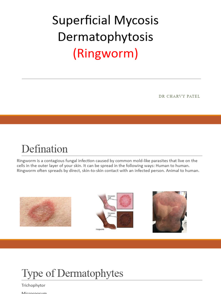 Ringworm | PDF