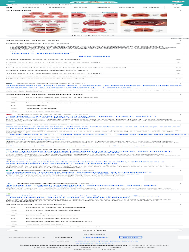 Normal Tonsil Size and Grading | PDF | Infection | Immunology