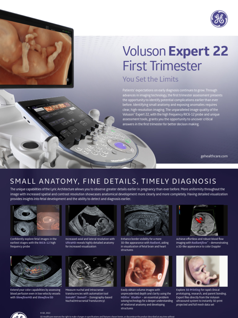 Voluson Expert22 First Trimester Sales Sheet JB18776XX | PDF ...