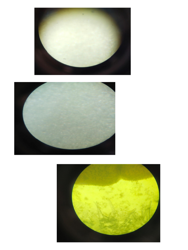 Seminal Analysis | PDF