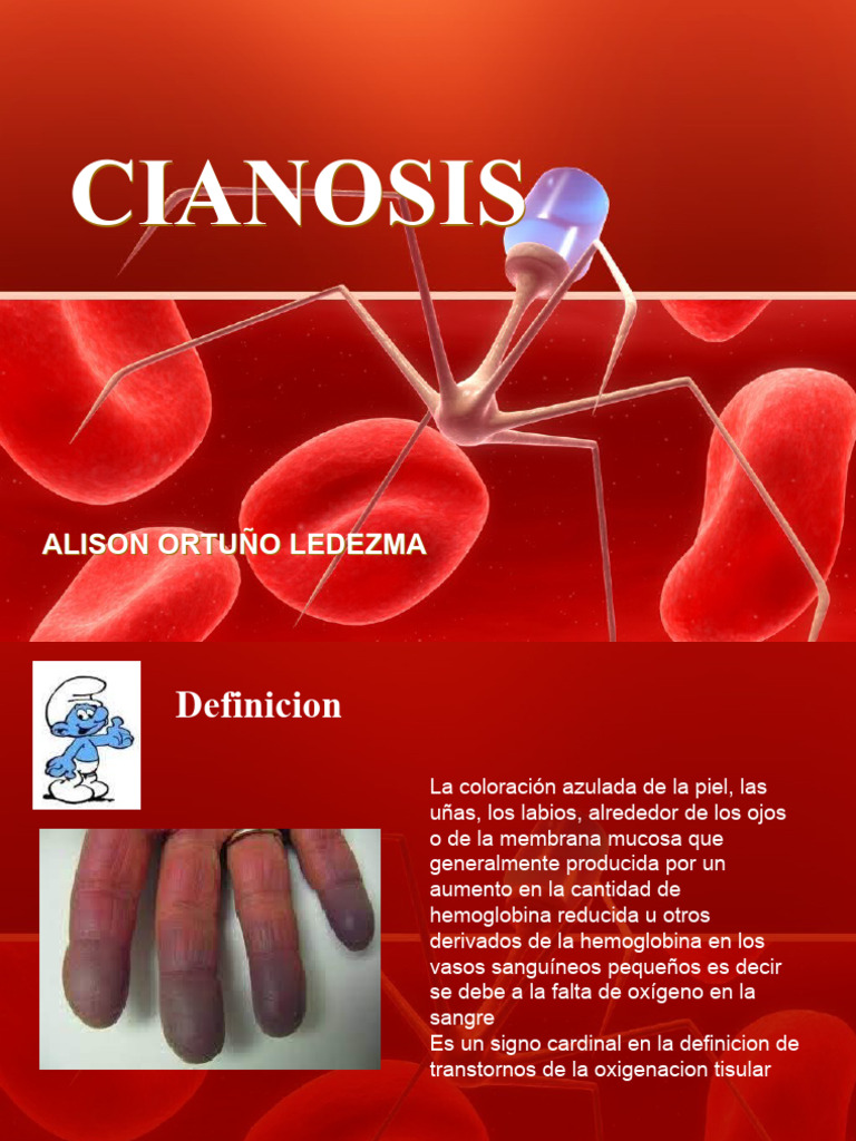 CIANOSIS... | PDF | Enfermedades y trastornos | Medicina