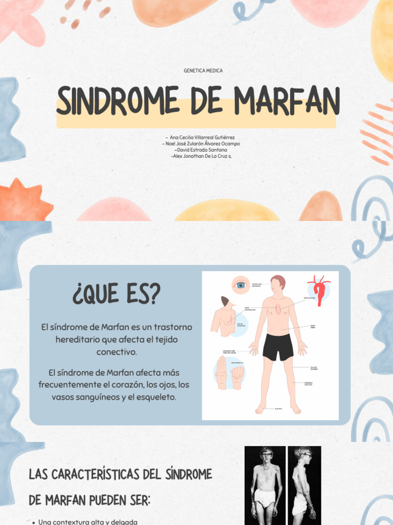 Sindrome de Marfan - 20231107 - 074857 - 0000 | PDF | Enfermedades y ...
