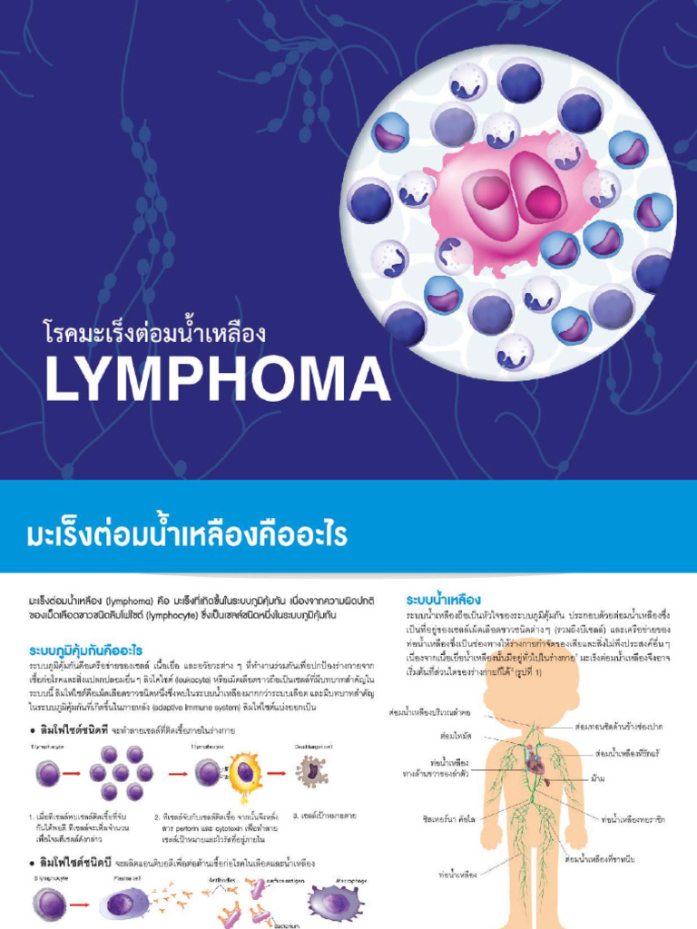 Lymphoma Book | PDF