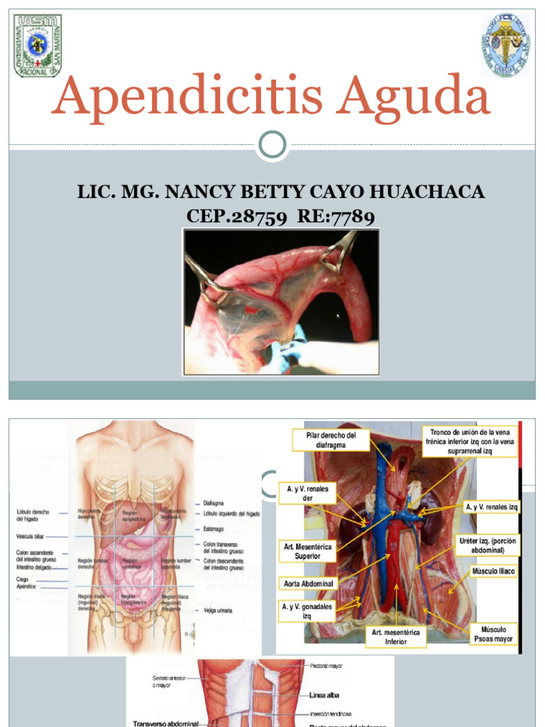 Apendicitis Aguda | PDF | Enfermedades y trastornos | Anatomía