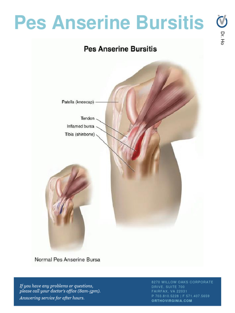 Ho Pes Anserinus Syndrome Exercises | PDF | Knee | Foot
