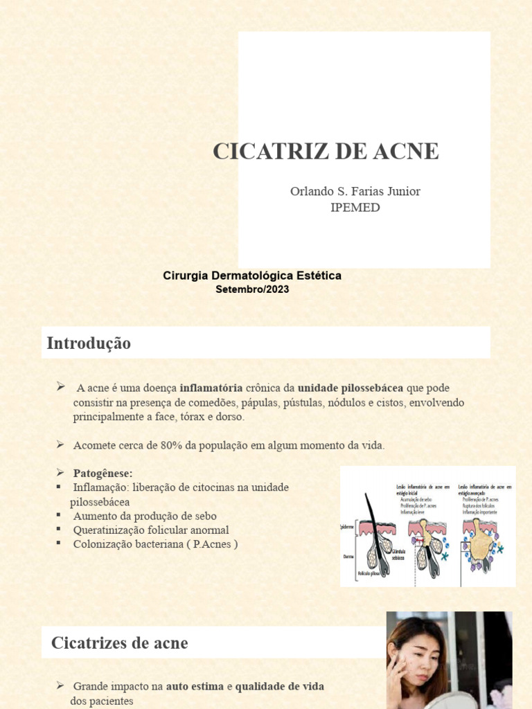 Cicatriz de Acne - Cópia | PDF | Medicina | Piel