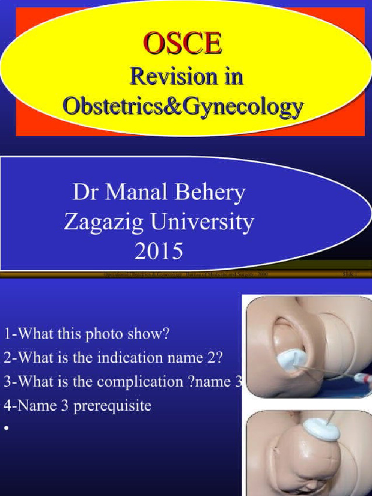 Osce Revision in Obstetrics and Gynecology | PDF