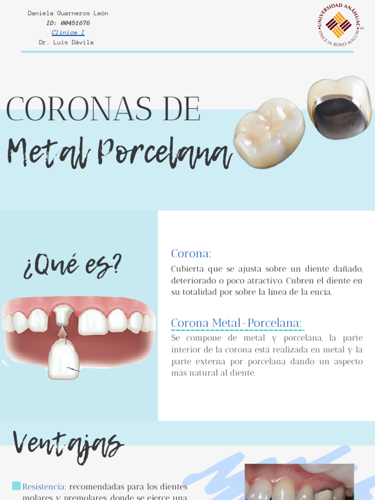 Coronas Metal Porcelana Presentación | PDF | Diente | Boca