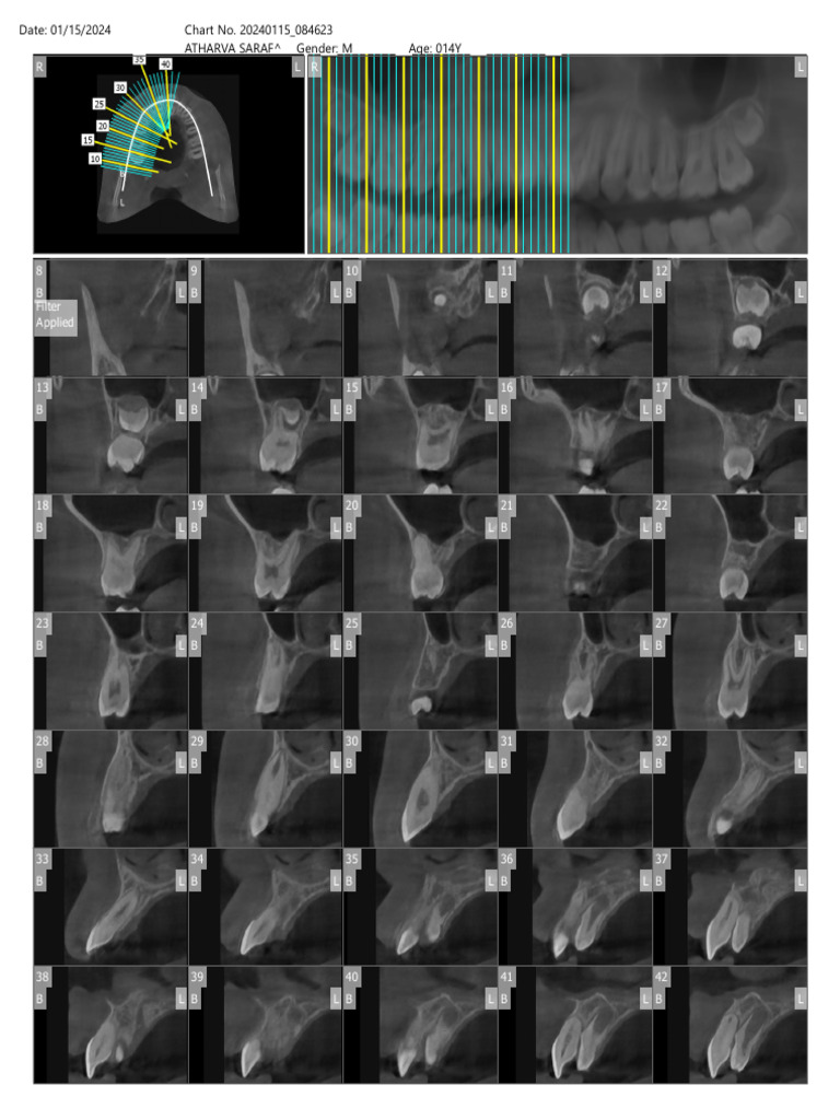 DRDCS Atharva Sharaf | PDF