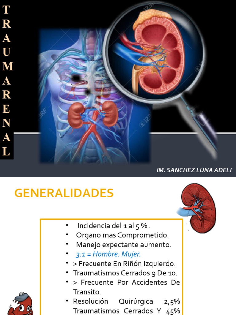 trauma renal | PDF | Lesión | Riñón