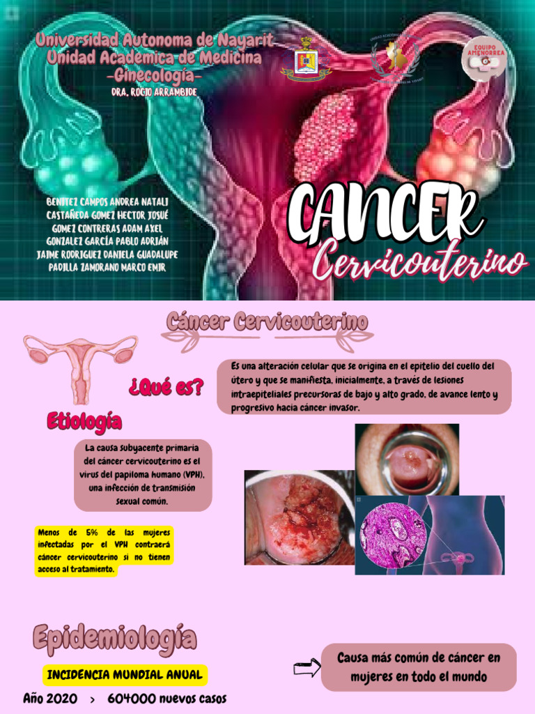 Cancer Cervicouterino | PDF