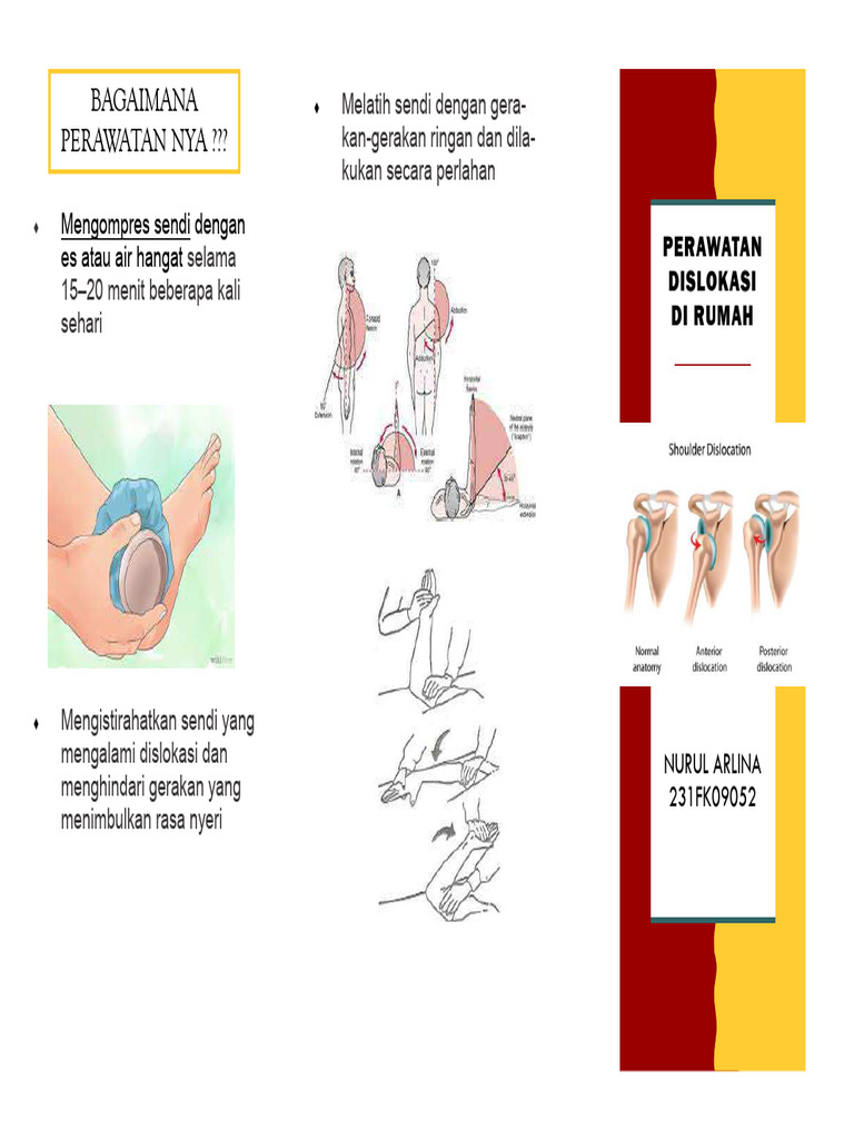 Leaflet Dislokasi | PDF