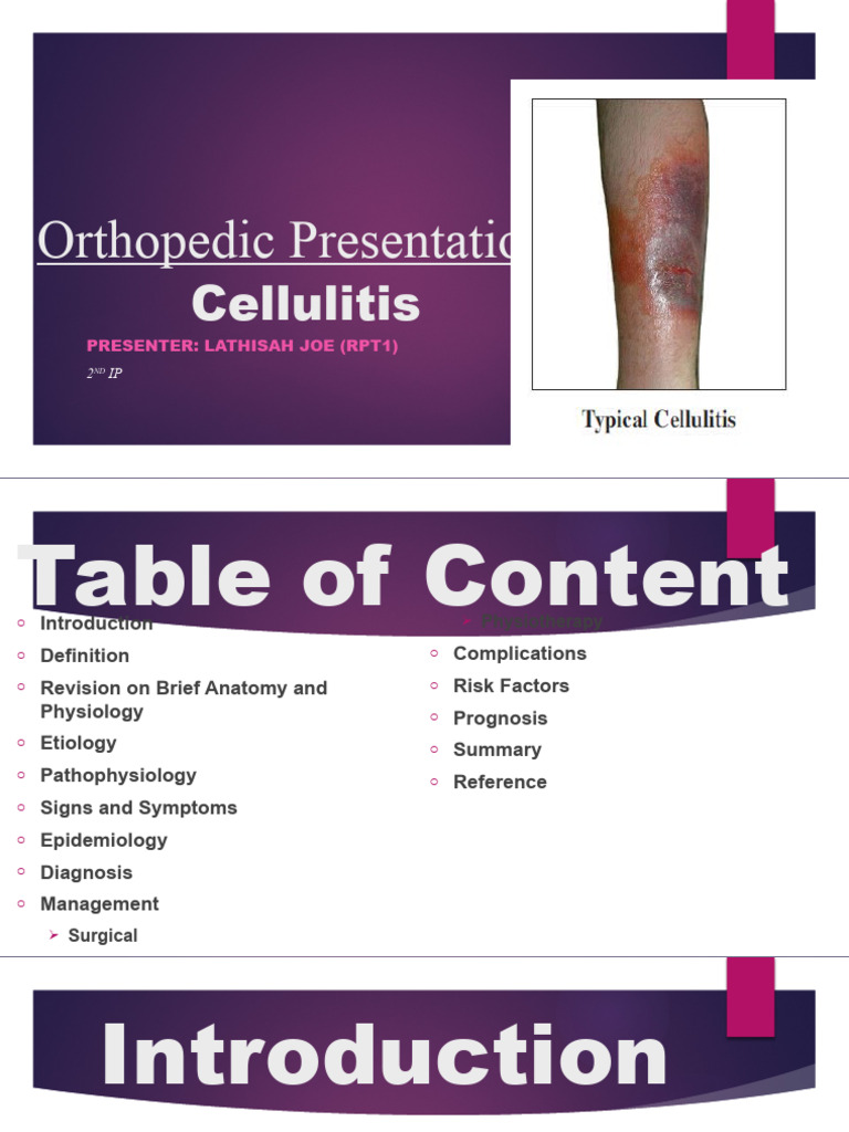Cellulitis | PDF | Epithelium | Infection