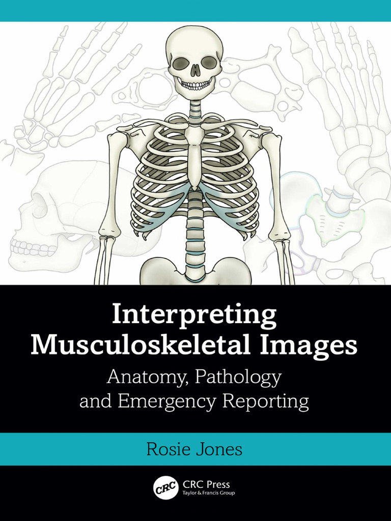 Interpreting Musculoskeletal Images Anatomy, Pathology and Emergency ...