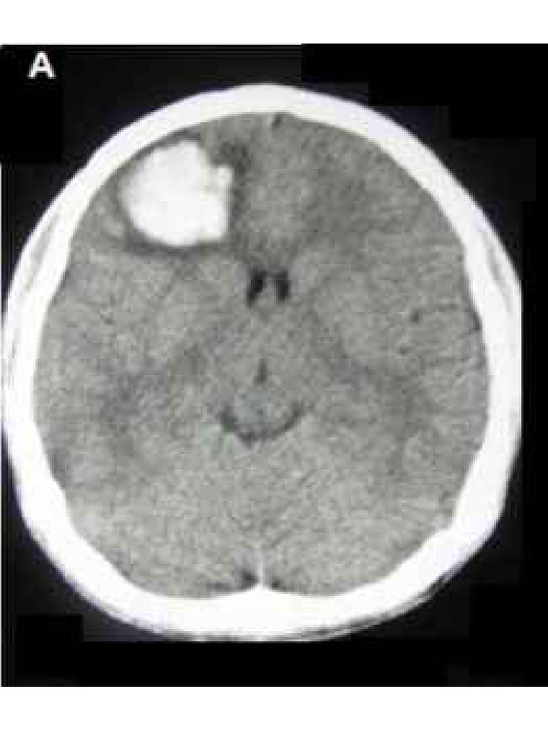 Hasil CT-scan (Bapak Ridho) Rsud DR - Doris | PDF