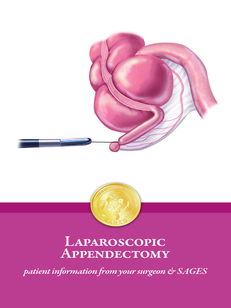 Appendectomy | PDF | Surgery | Medical Specialties