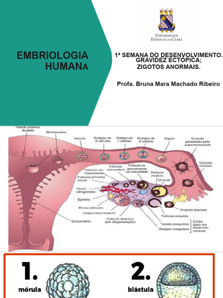 Aula 03 - Embriologia Humana - 1ºsemana GR | PDF | Gravidez | Síndrome ...