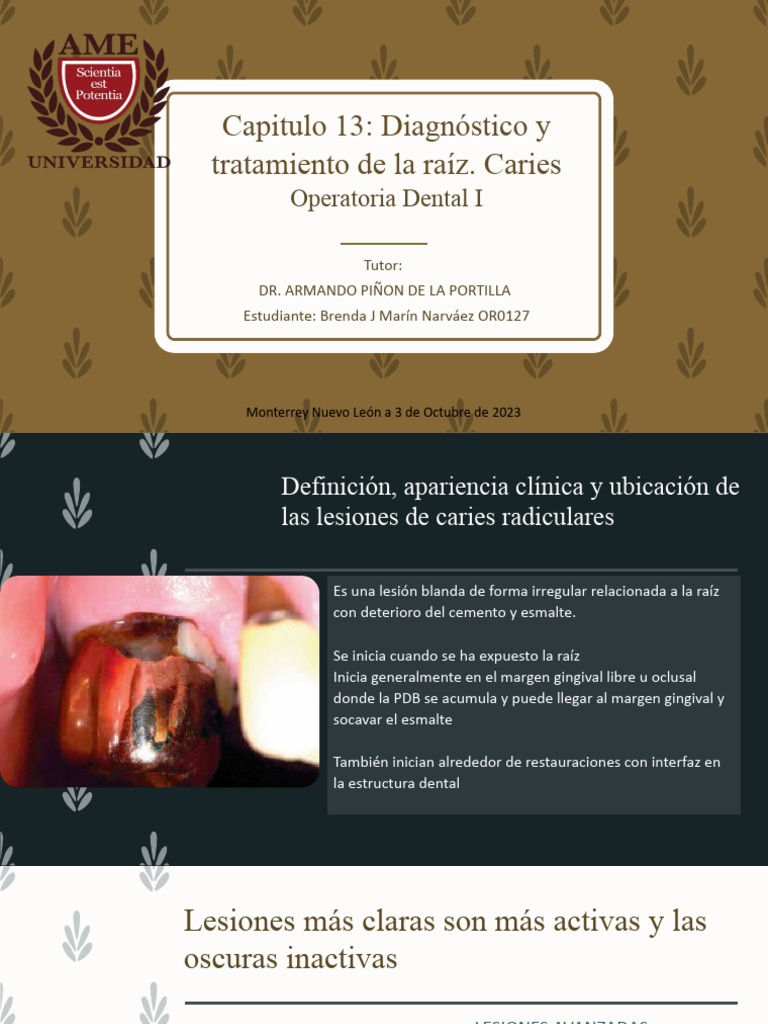 Capitulo 13 Caries Radicular | Descargar gratis PDF | Compuesto Dental ...