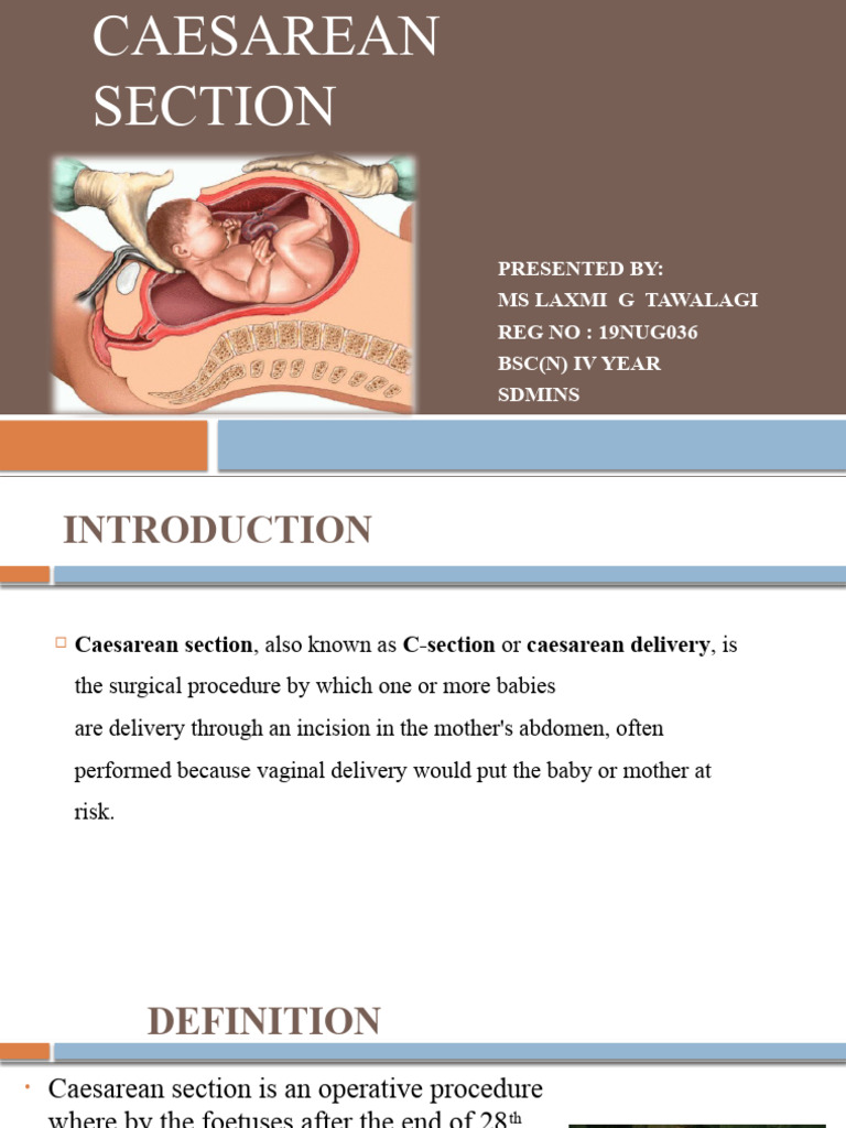 Cs Obg | PDF | Caesarean Section | Childbirth