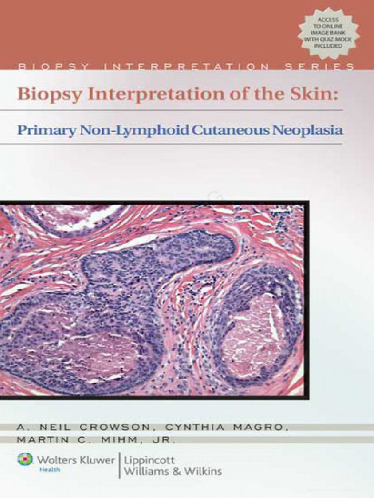 Biopsy Interpretation of The Skin, 1E (2010) (PDF) (UnitedVRG) | PDF | Epidermis | Integumentary ...