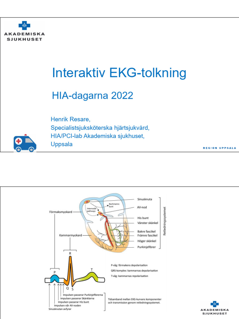 Interaktiv Ekg Tolkning | PDF