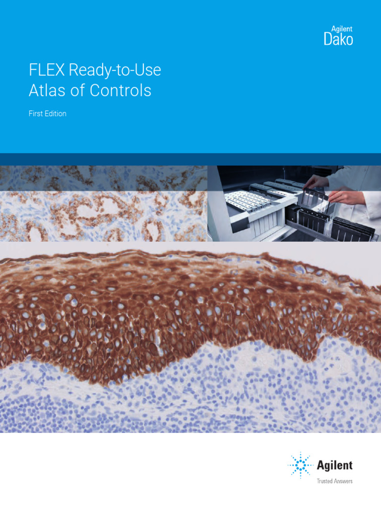 Atlas of Controls - 1st Edition | PDF | Immunohistochemistry ...