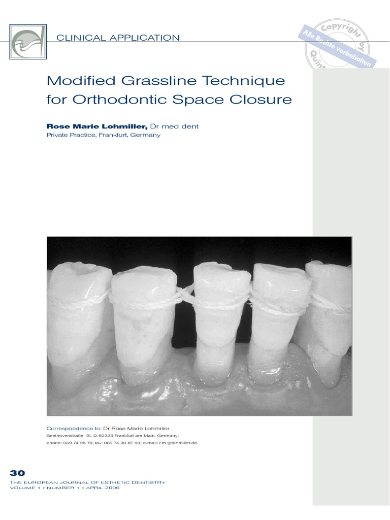 03 - Modified Grassline Technique For Orthodontic Space Closure | PDF ...