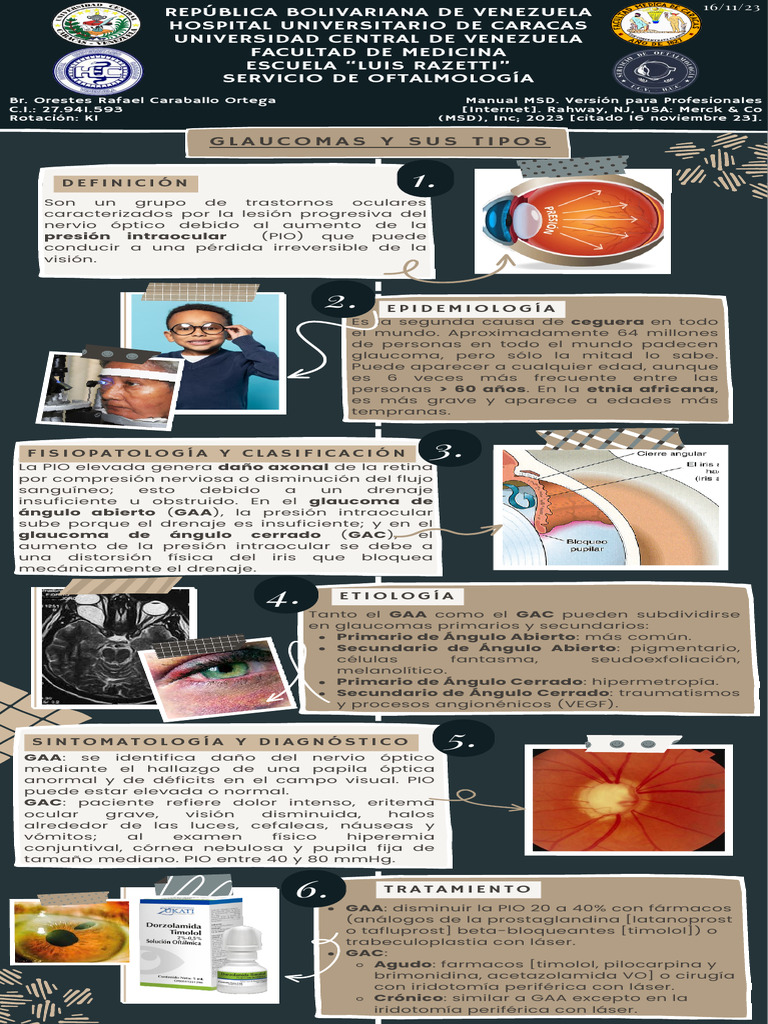 Glaucoma y Sus Tipos (Infografía) | PDF | Glaucoma | Causas de la muerte