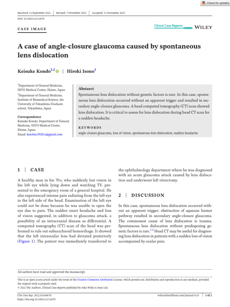 Lens Dislocation Leading to Glaucoma | PDF | Glaucoma | Ct Scan