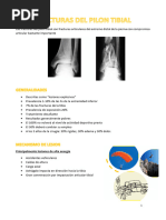 Fractur de Diafisis de La Tibia | PDF | Ct Scan | Hueso