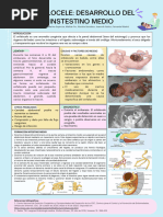 Persistencia del Conducto Onfalomesentérico | PDF | Anatomía ...