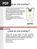 Preparaciones para Inlay, Onlay y Overlay | PDF | Boca | Odontología