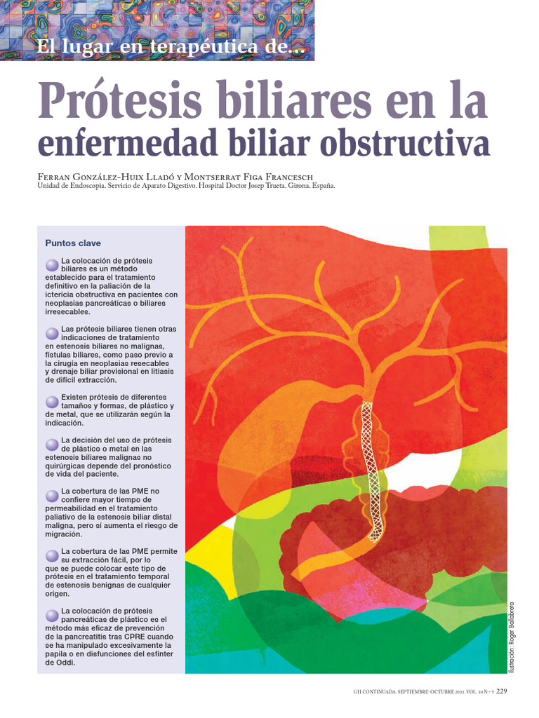 Prótesis Biliares en La: Enfermedad Biliar Obstructiva | PDF ...