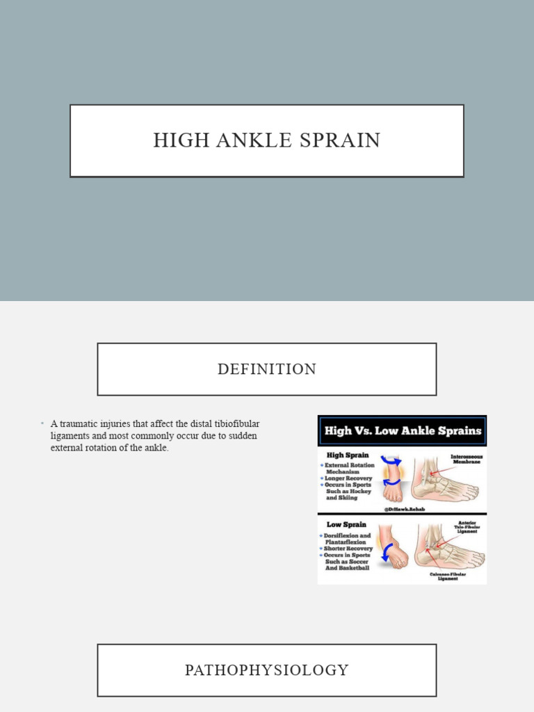 High Ankle Sprain | PDF | Ankle | Lower Limb Anatomy