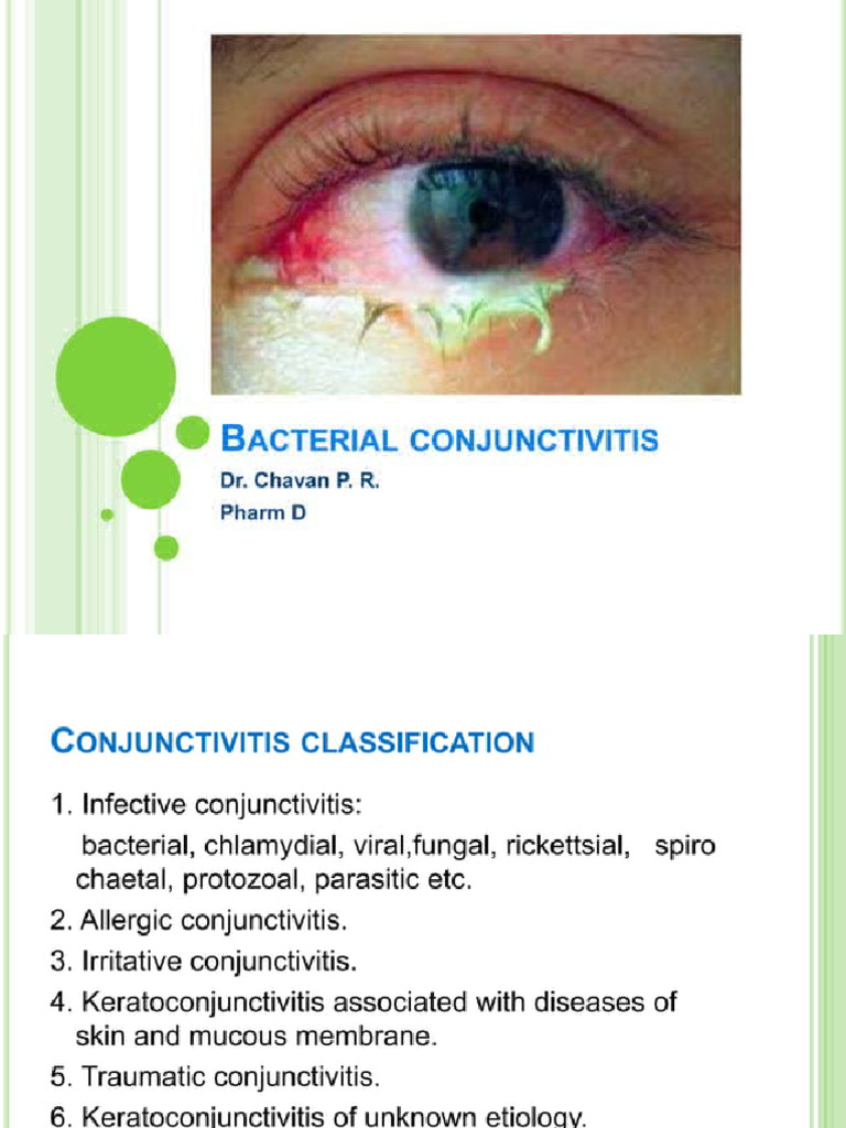 Bacterial Conjunctivitis Pharmacotherapy | PDF