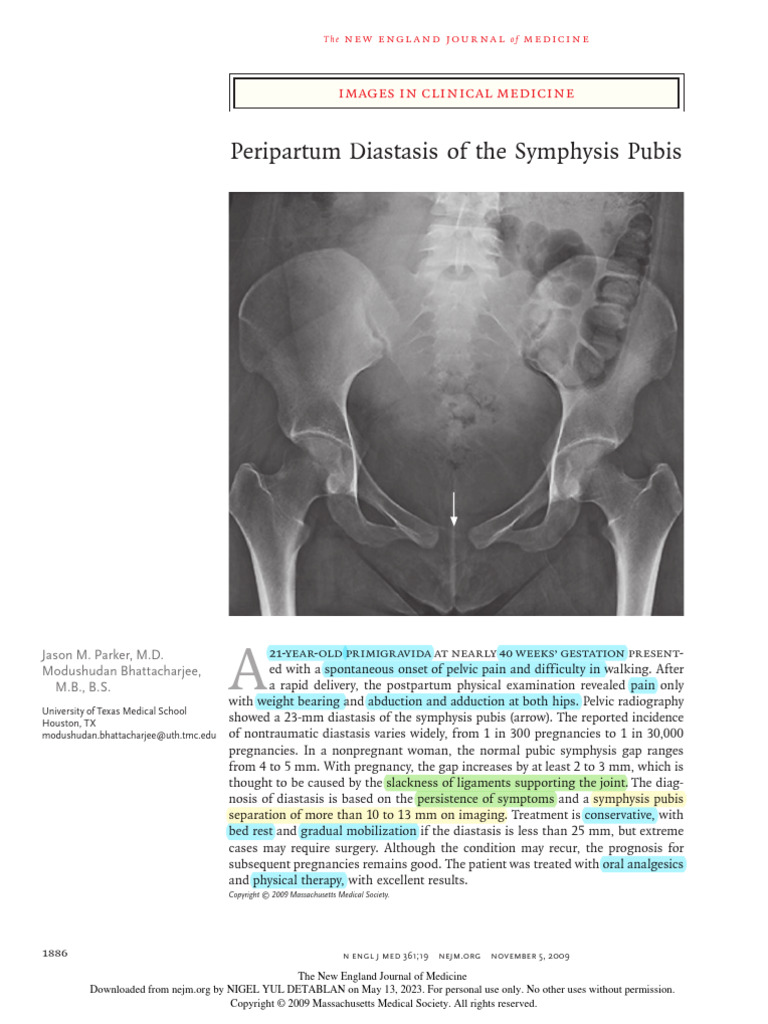 (NEJM, Nov 2009) - Peripartum Diastasis of The Symphysis Pubis (Images ...