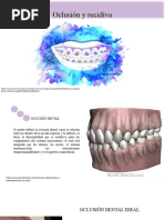 Tipping y Torque en Ortodoncia | PDF | Especialidades Medicas | Ramas ...