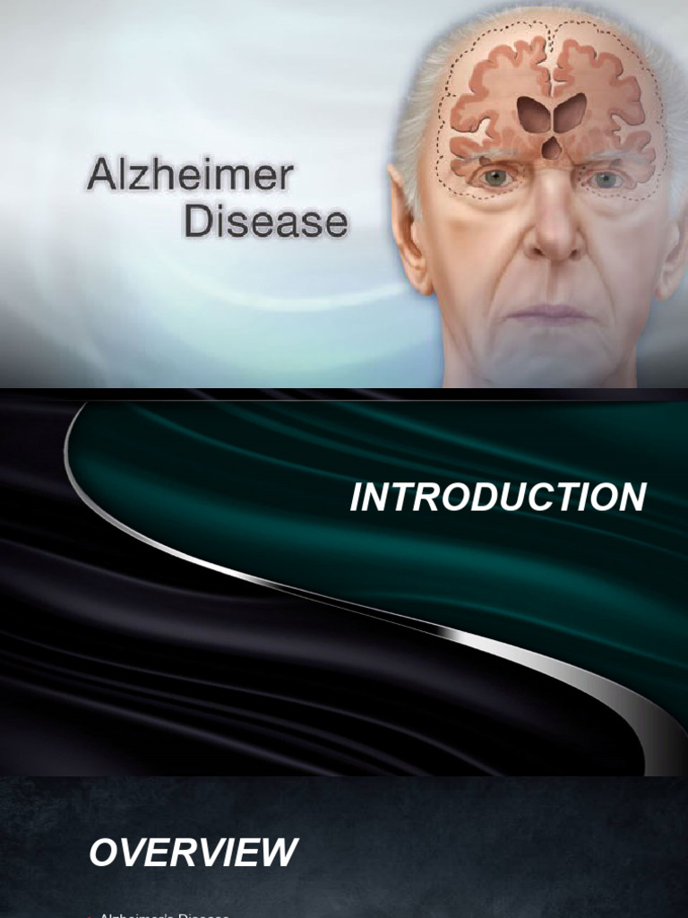 Alzheimer's Disease (Presentation) | PDF | Alzheimer's Disease | Memory