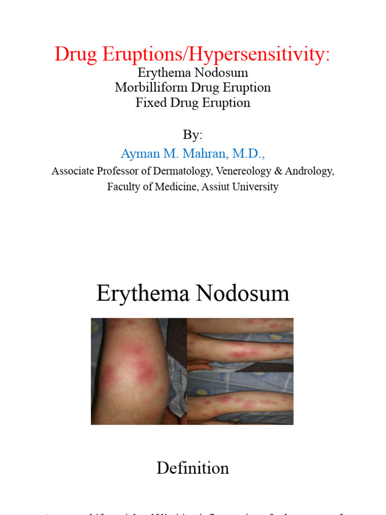 Drug Eruptions 2 Medical Students-1 | PDF | Health Sciences | Dermatology