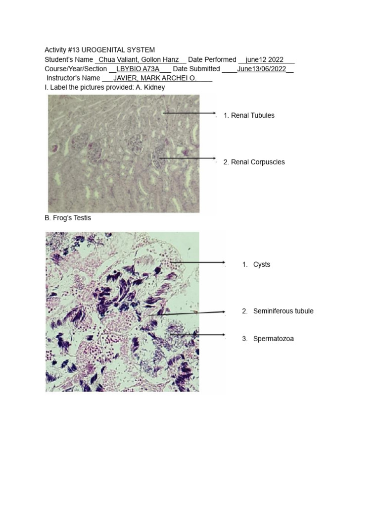 Act 13 (Gollon, Hanz. Chua Valiant) UROGENITAL SYSTEM | PDF | Testicle ...