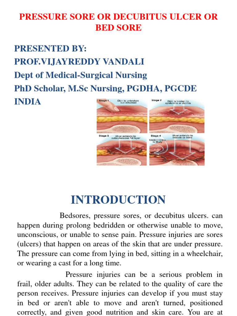 Pressure Sore or Decubitus Ulcer or Bed Sore | PDF | Wound | Causes Of Death