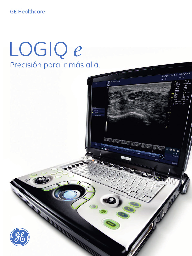 LOGIQ e | PDF