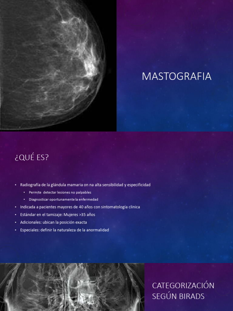 Mastografia | Descargar gratis PDF | Pecho | Cáncer de mama
