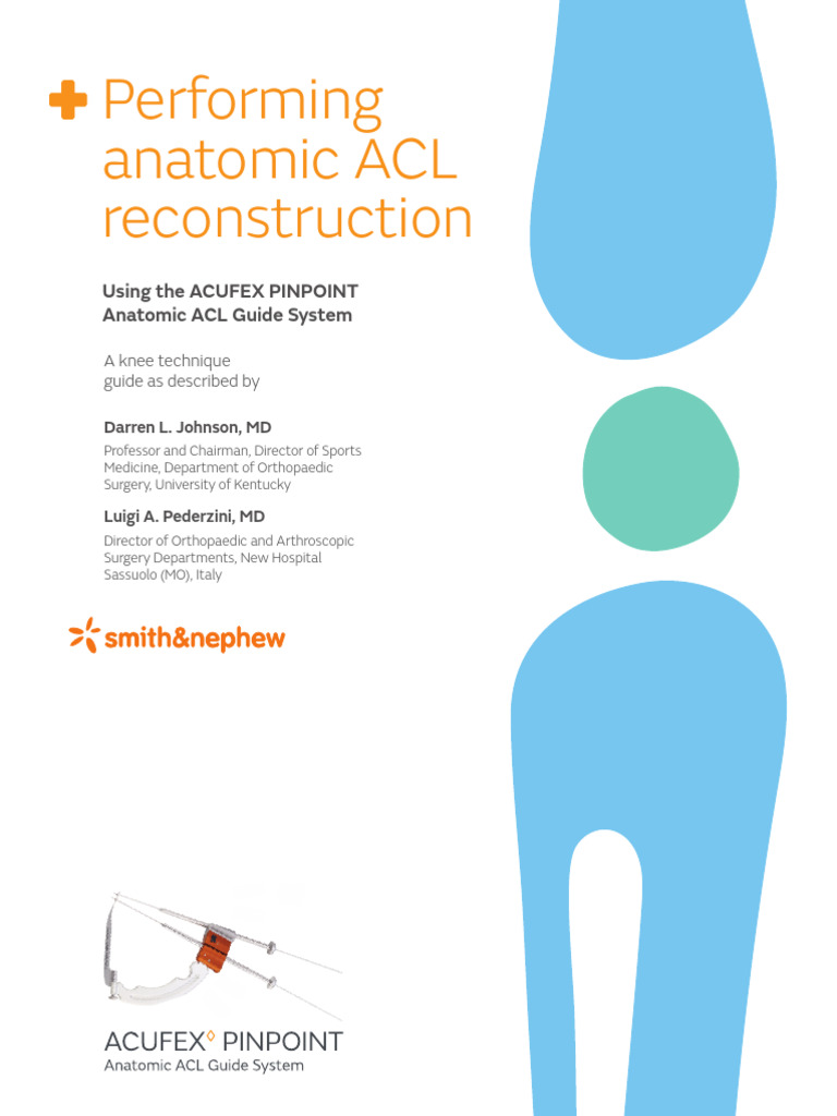 ACUFEX Anatomic ACL Reconstruction Guide | PDF | Knee | Lower Limb Anatomy