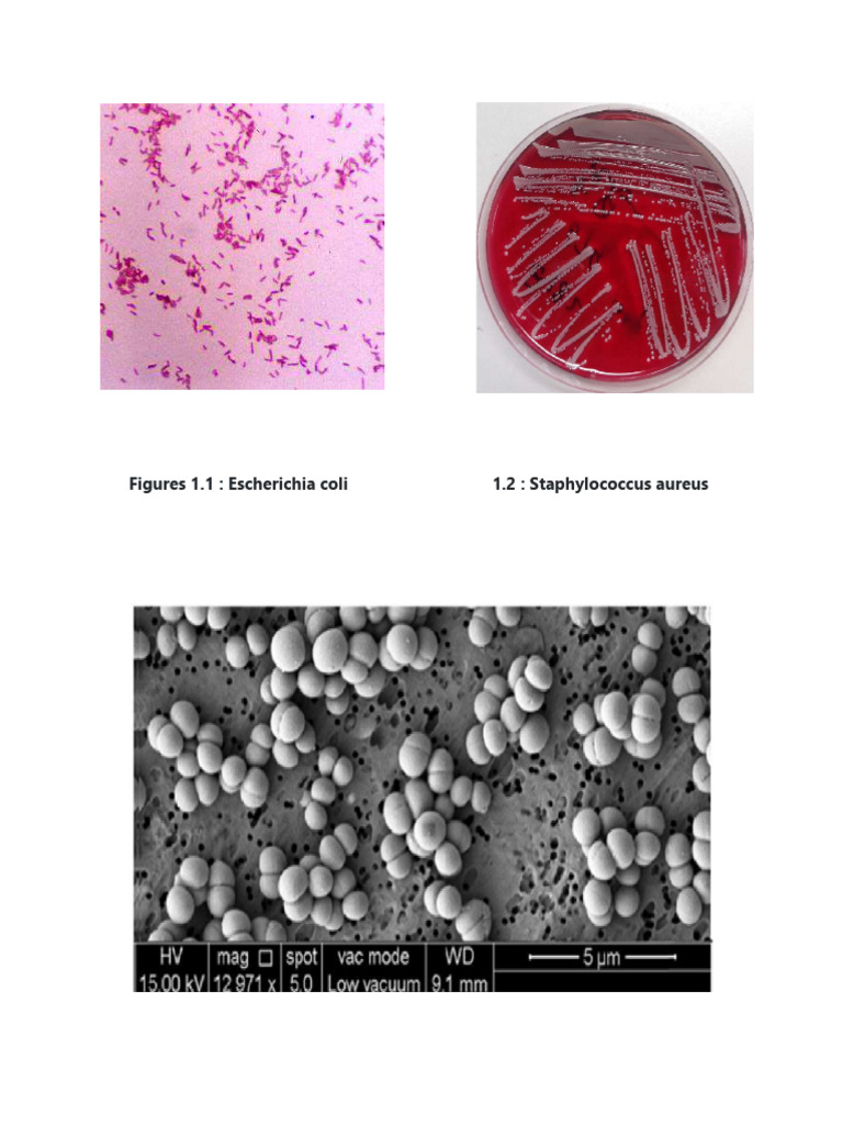 Figures 1.1: Escherichia Coli 1.2: Staphylococcus Aureus | Download ...