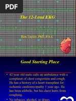 ECG Axis Interpretation Guide | PDF | Electrocardiography | Cardiology