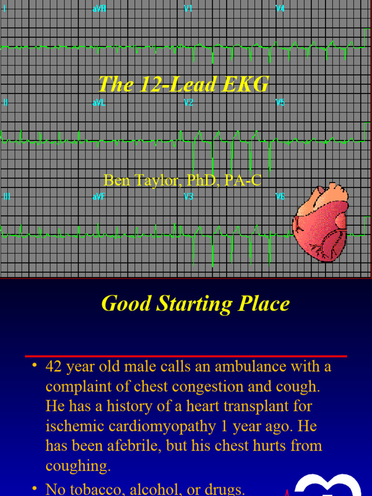 12-lead EKG (EMT Presentation) | PDF | Electrocardiography | Artificial ...