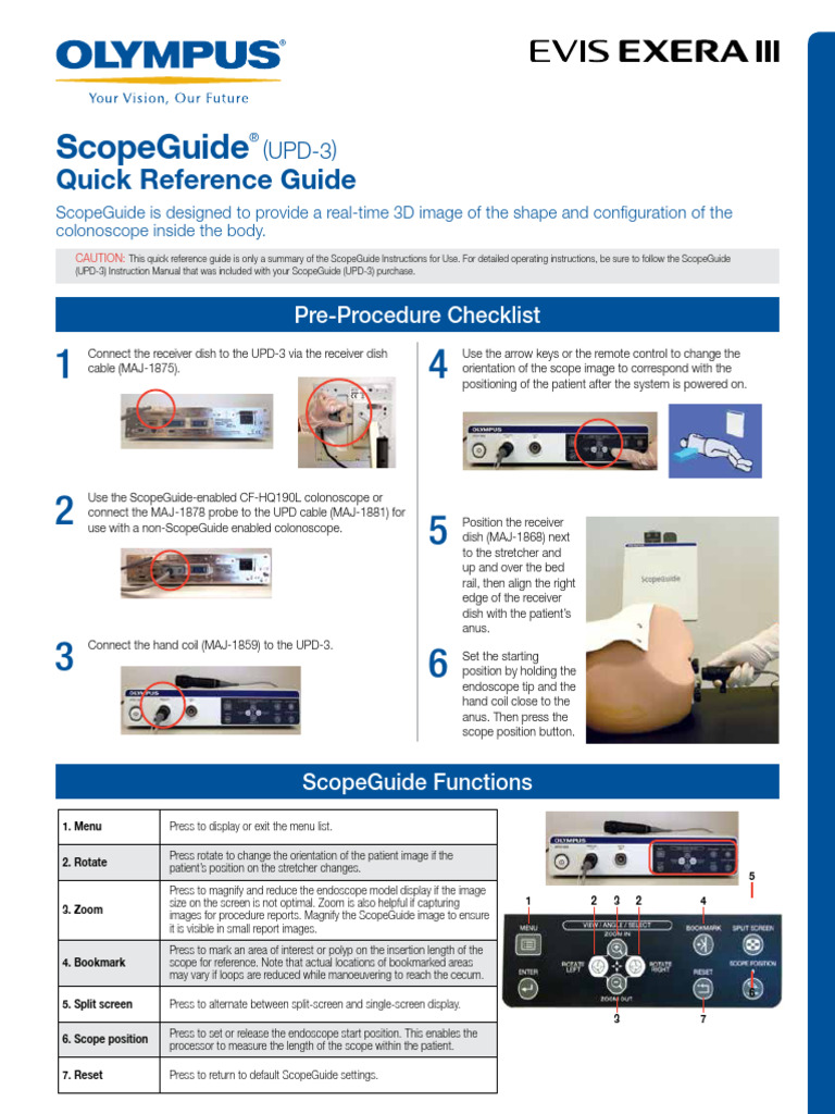 Scope Guide Quick Reference Guide | PDF | Colonoscopy | Equipment
